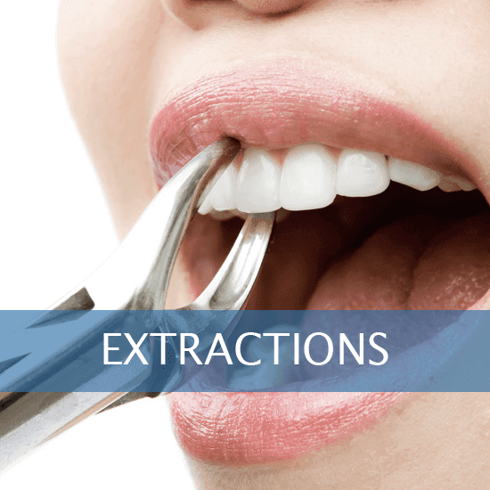Extractions - Friendly Dental of Worcester